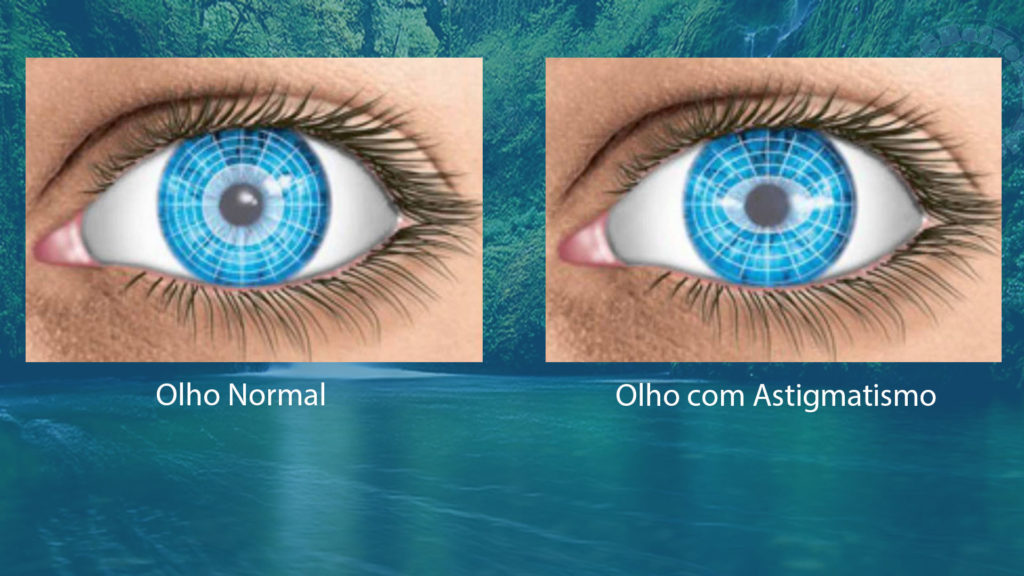 Visao De Astigmatismo